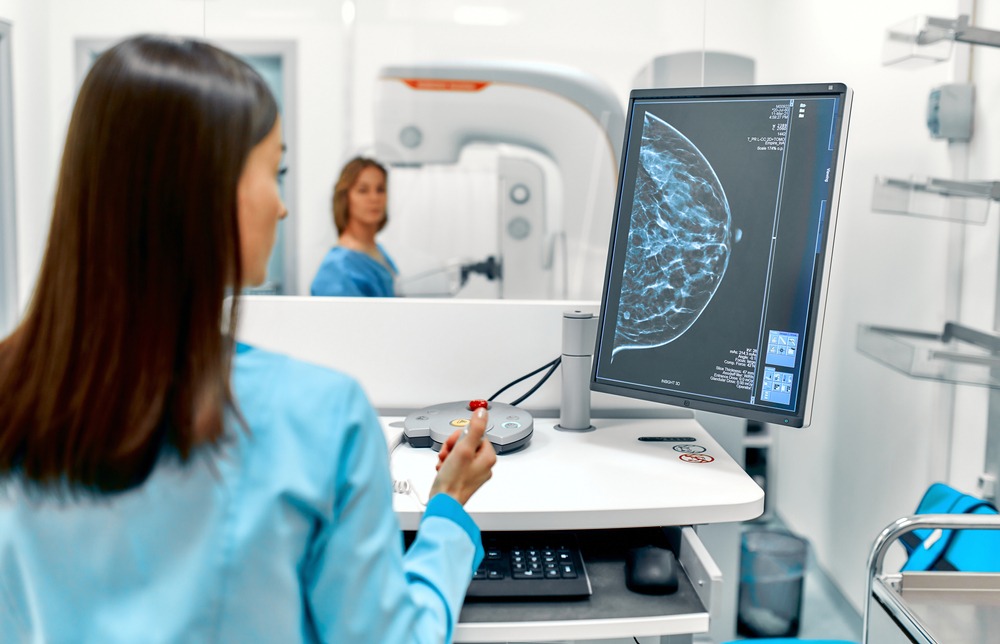 AI in Breast Cancer Screening: UK Launches Largest Trial